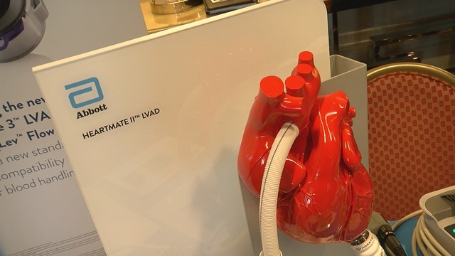 Transplant shortage means more living with implanted heart pumps ...